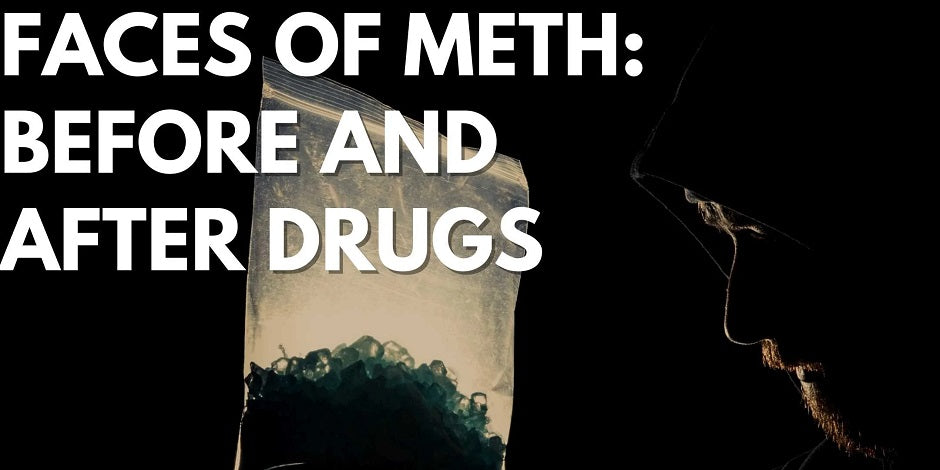 Faces Of Meth: Before And After Meth Addiction